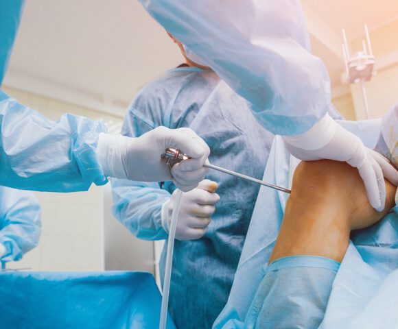 Cirugía de rodilla en Valencia - Corbi Clinic