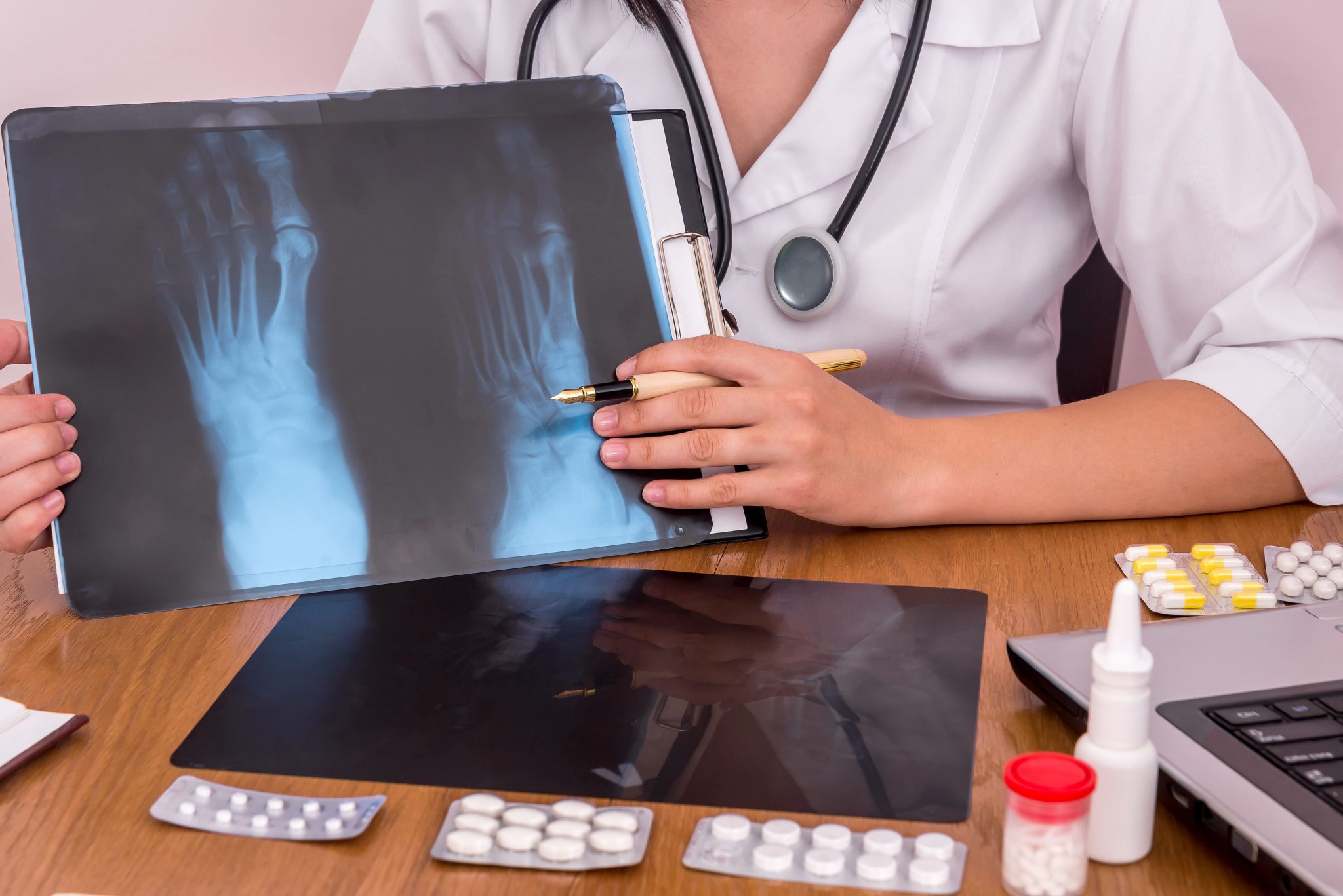 ¿Por qué es importante acudir a un traumatólogo que puede operarte ...