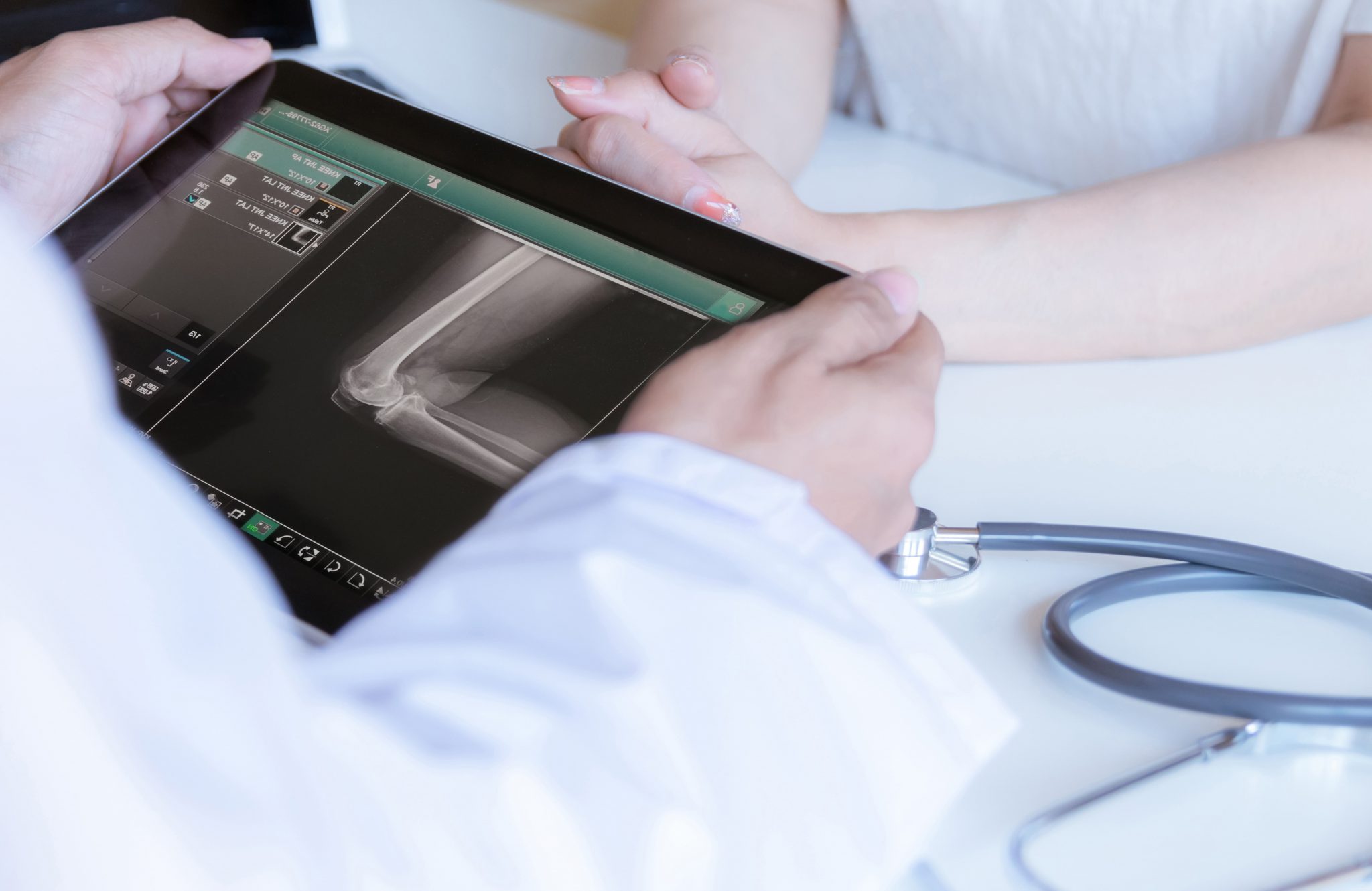 ¿Qué papel juega un traumatólogo en el cuidado de la cadera? - Corbi Clinic